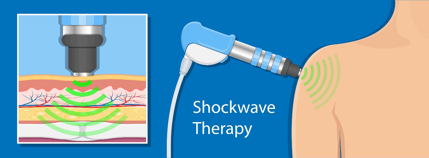 Shockwave Physiotherapy Sydney | Hunters Hill Clinic